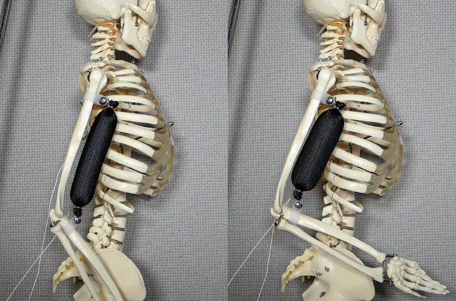 Humanoid robots a 'strong' step closer with synthetic muscle that can ...