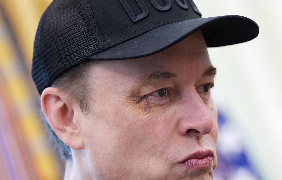 Elon Musk left with black eye after 'being punched' by his five-year ...